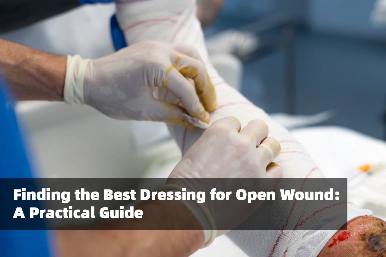 Finding the Best Dressing for Open Wound: A Practical Guide – CEEPORT