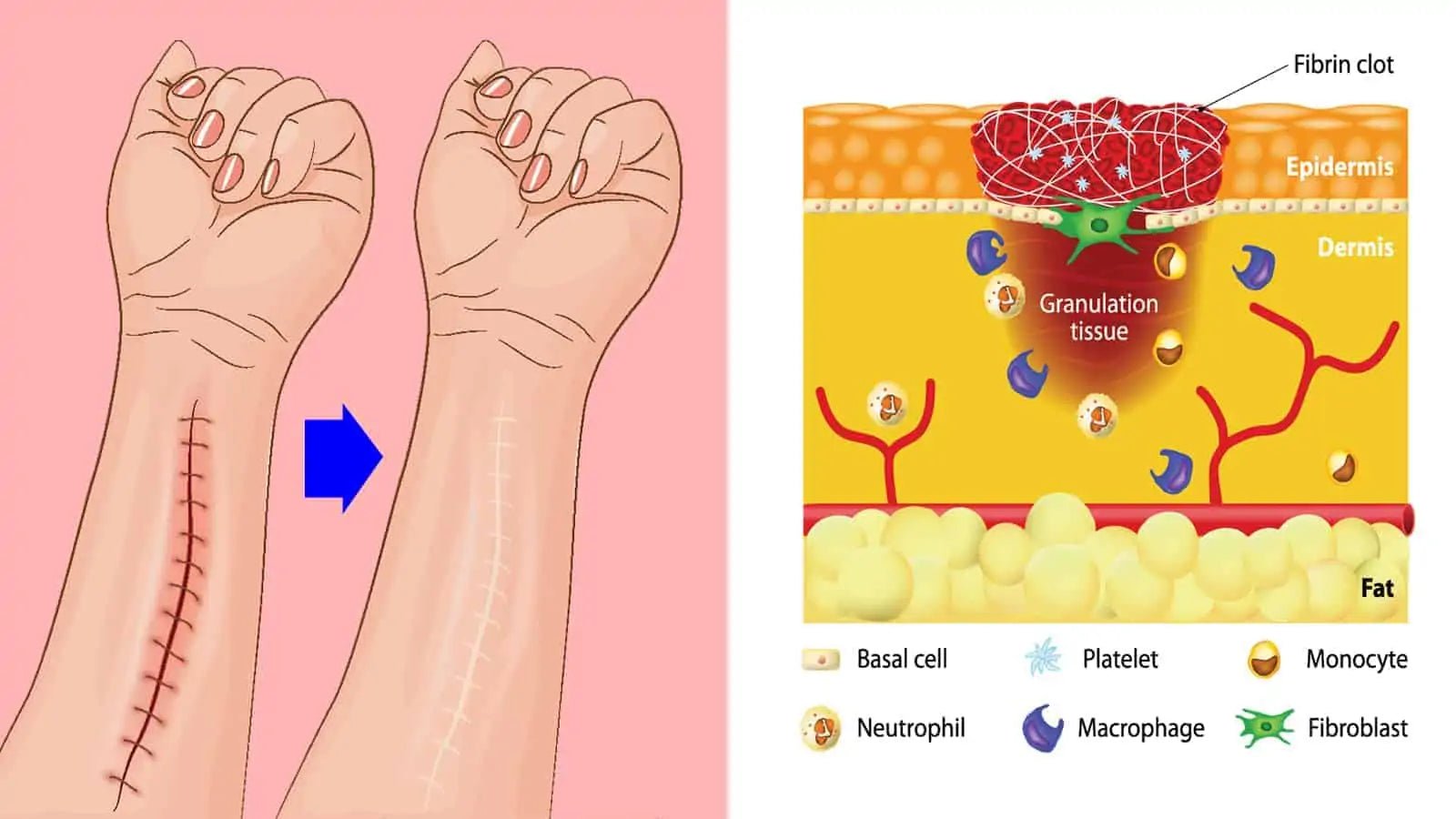 Sterile Dressing Guide: Why Sterile Gauze Dressing Matters in Wound ...